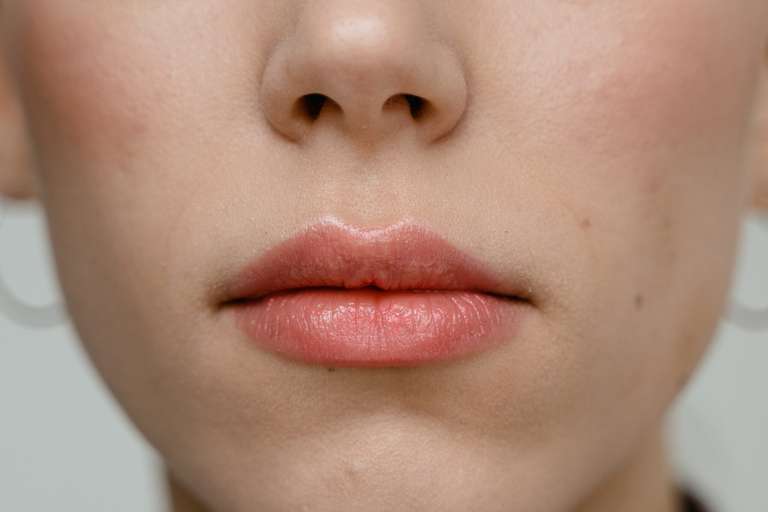What is the medical term for the upper lip? - Smile Widely